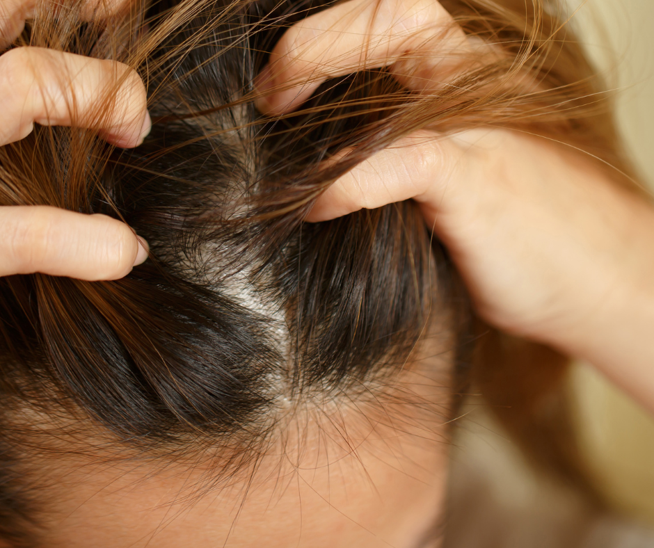 Rambut Putih Pada Usia Muda: Penyebab dan Cara MenanganinyaRambut Putih ...