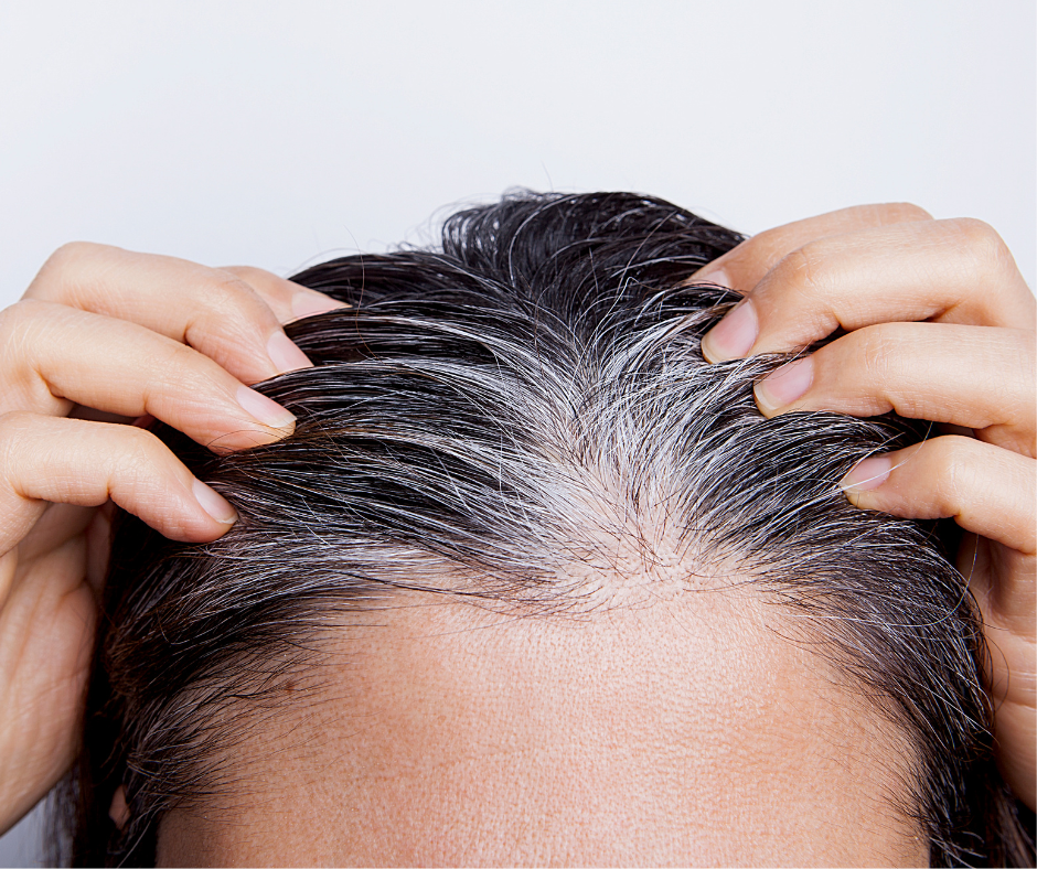 Rambut Putih Pada Usia Muda: Penyebab dan Cara MenanganinyaRambut Putih ...